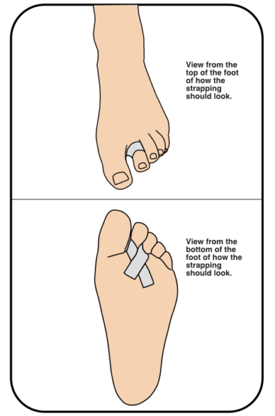 Ball of Foot and Toe Pain – NHS Forth Valley